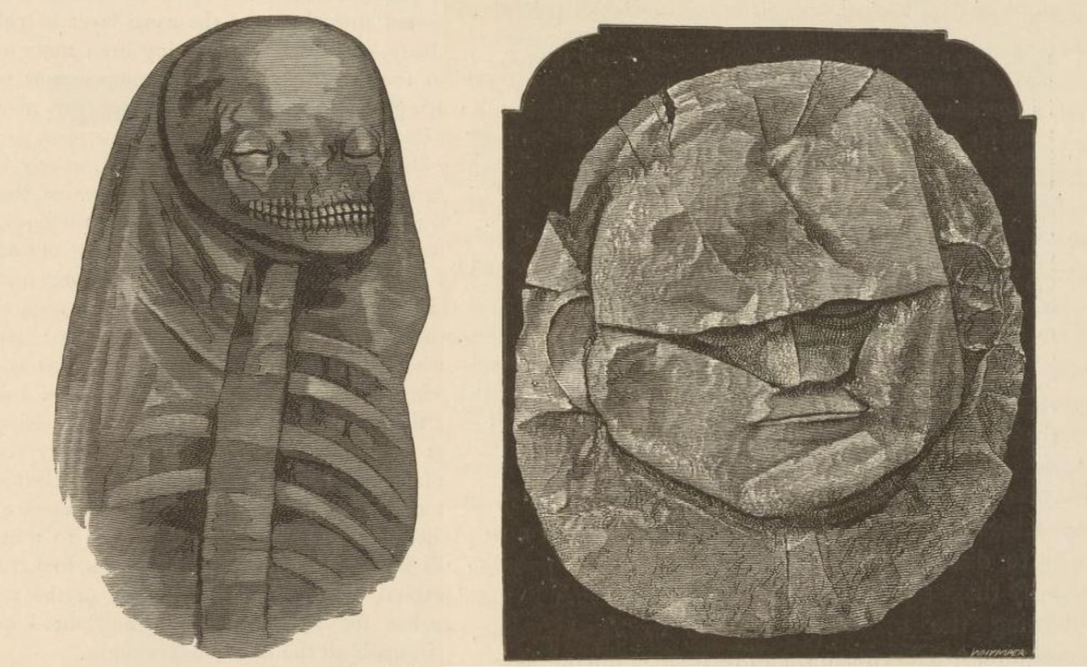 Schliemann und die mykenische Mumie - Wunderkammer der Kulturgeschichte
